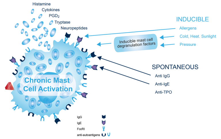 Chronic Urticaria – MC Sciences